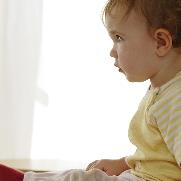 Cradle cap, or infantile seborrheic dermatitis | Brunet